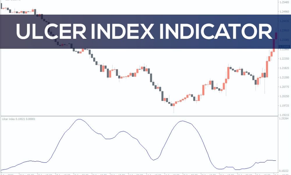 Ulcer Index là gì? Cách tính và ứng dụng đánh giá rủi ro - Tin tức FX